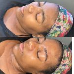 Best Facial in Kansas City: The Bar Method | The Facial Bar